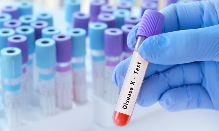 D012感染症免疫学的検査 区分：El（既存）SARS-CoV-2・インフルエンザウイルス抗原同時検出 D012感染症免疫学的検査 区分：E3（新項目）SARS-CoV-2 ・RSウイルス抗原 ...