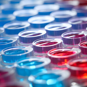 腫瘍マーカー：CA19-9[ラボ NO.553（2025.2.発行）より] | 一般社団法人日本臨床検査専門医会｜臨床検査医になるために